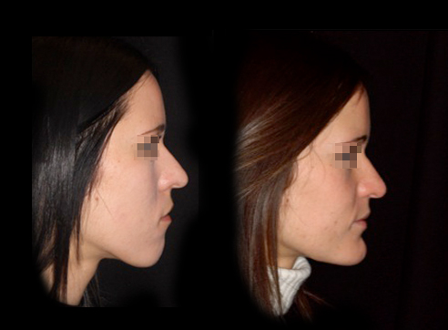 Paolo Morselli | Chirurgia Plastica ed Estetica Bologna Rimini ...