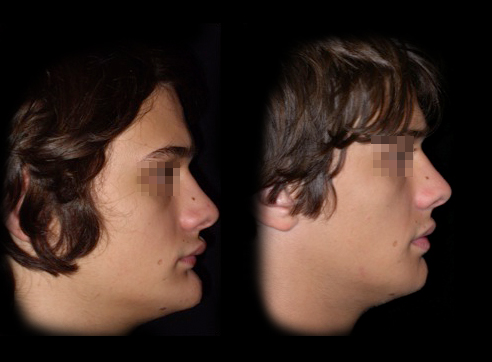 Paolo Morselli | Chirurgia Plastica ed Estetica Bologna Rimini ...