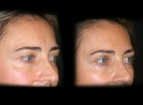 Paolo Morselli | Chirurgia Plastica ed Estetica Bologna Rimini ...