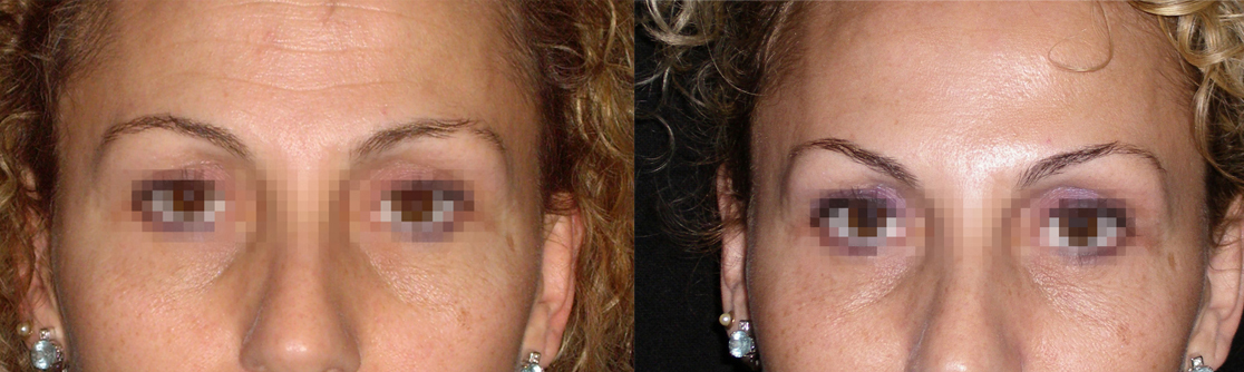 Paolo Morselli | Chirurgia Plastica ed Estetica Bologna Rimini ...